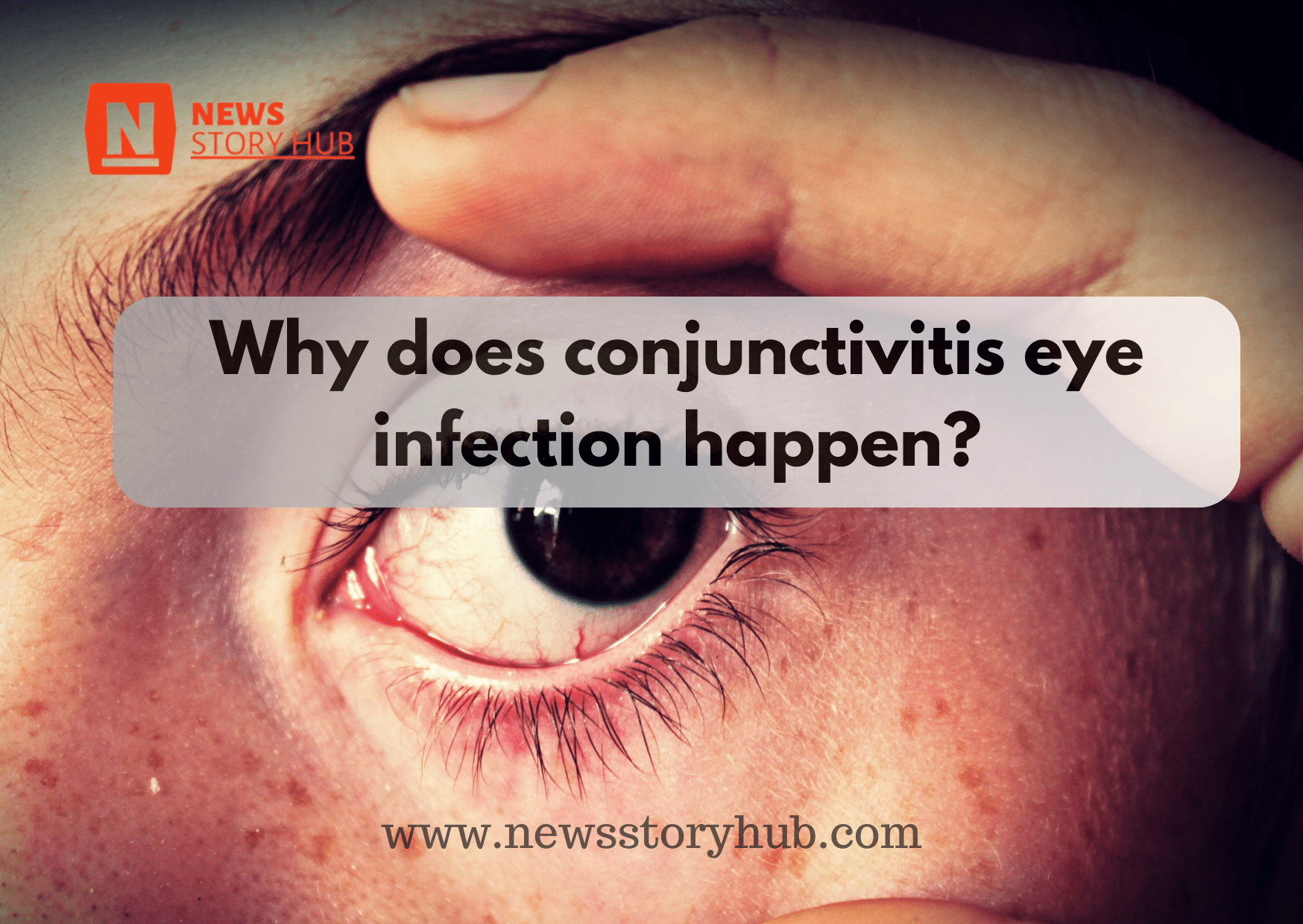 Why Does Conjunctivitis Eye Infection Happen?